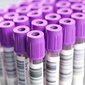 China 5ml EDTA K2 K3 Tube PET Or Glass Blood Collection Tube for sale