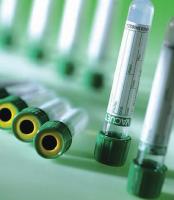 China Green Top Sodium Heparin Blood Collection Tubes Heparin Lithium Sodium Tube for sale
