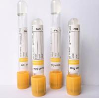 China CE Certified Vacuum Venous Yellow Cap Gel Clot Activator Serum Blood Collection Tube for sale