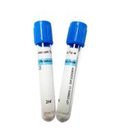 China PT Tube Medical Blood Test 3.2% Sodium Citrate Vacuum Blood Collection PT Tube With Blue Top for sale
