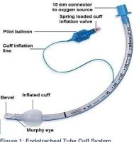 China Standard Endotracheal Tube Cuffed High Volume Available With Magil Type DEHP-FREE Material for sale