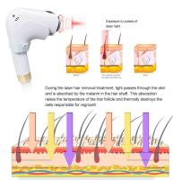 China 755nm 808nm 1064nm Diode Laser Hair Removal Machine For Bikini Legs for sale