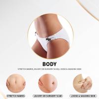 China New arrivals 2022 rf micro needling rf radio frequency skin tightening machine for sale