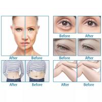 China 2022 2 Handle Dual Control 7D Hifu Machine For Skin Tightening And Body Slimming for sale
