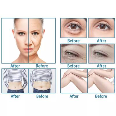 China 2022 2 Handle Dual Control 7D Hifu Machine For Skin Tightening And Body Slimming for sale