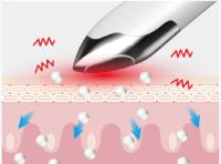 China professional manufacturer eye wrinkle remover eraser facial massage with rf and ems for sale