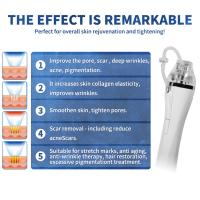 China 2022 New Technology MMFU 3D 4D 6D 7D HIFU Former 12 Lines 20000shots Machine Face Lifting Anti-wrinkle Microneedle RF for sale