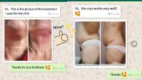 China cryo360 cryolipolysis machine price/fat removal machine cryolipolysis slimming machine fat freezing for sale