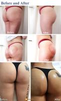 China Female Electric Beautiful Enhancer Boobs Care Hot Big Breast Enlargement Machine Vibrating Breast Massager for sale
