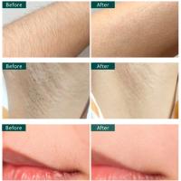 China Titanium 755nm 1064nm Diode Laser Hair Removal Machine Laser Depilation Device 3 Wavelength for sale