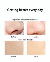 China Portable Ultrasonic Skin Scrubber Pores Cleansing Anti Aging Instrument for sale