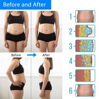 China Safe Cryolipolysis Belt Slimming Fat Freezing Machine Cryopad Cooling Weight Loss for sale