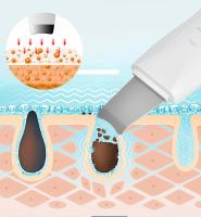 China Rechargeable Face Skin Scrubber Ultrasonic Peeling Blackhead Removal for sale