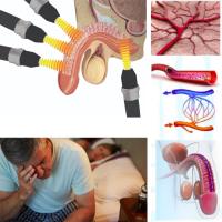 China ESWT Rehabilitation Center Shockwave Therapy Machine 5000000 Shot for sale