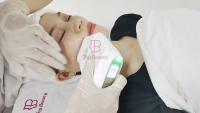China 9D Facial Skin Wrinkle Remover Device Face Lifting Machine 20000 Shots for sale
