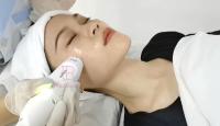 China 9D Facial Skin Wrinkle Remover Device Face Lifting Machine 20000 Shots for sale