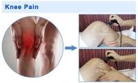China Smart Tecar Therapy Machine Body Rehabilitation Diathermy Physical Capacitive Resistive Energy Transfer for sale