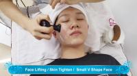 China 300W Ceramic CET Tips Slimming Beauty Machine For Commercial for sale