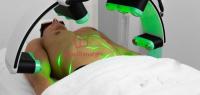 China 10d Laser Slimming Machine Weight Loss 532nm Green Emerald Laser Machine for sale