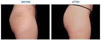China Ems Stimulate Body Sculpt Machine Muscle Buidling Neo Muscle Sculpt Machine for sale