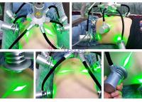 China 532nm Lipo Laser Body Slimming Machine Fat Burning Emerald Laser Machine for sale