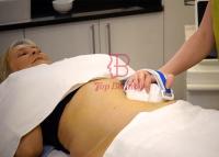 China Ultrasound 4D Cavitation Slimming Machine Vacuum Body Cellulite Removal for sale