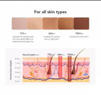 China Vertical Big Spot Size YAG IPL Diode Laser Device 808nm Diode Beauty Equipment for sale