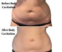 China Ultrasound 4D Cavitation Slimming Machine Vacuum Body Cellulite Removal for sale