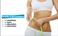 China 5 In 1 3D Cavitation Slimming Machine Ultrasonic Vacuum RF Photon Fat Burning Machine for sale