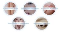 China PicoSecond Laser 532nm 755nm IPL beayty Machine For Treatment Pigmentary for sale