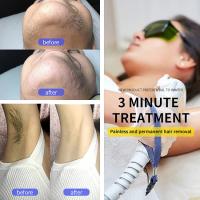 China Painless YAG IPL Diode Laser Device Portable 755 808 1064nm Laser Hair Removal Epilator for sale