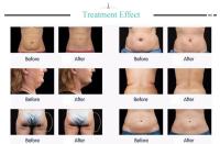 China Home 80K Ultrasound Cavitation Body Slimming Machine Tripolar for sale