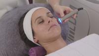 China LDM Ultrasound Skin Rejuvenation Machine Low Frequency Dual Frequency for sale