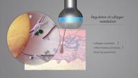 China LDM Ultrasound Skin Rejuvenation Machine Low Frequency Dual Frequency for sale