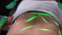 China 10D Cold Laser Therapy Machine Green Diode Light Emerald Laser Liposuction Lypolysis Master Machine for sale