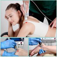 China Focused Shockwave 1064nm Lllt Laser Therapy Physiotherapy Machine for sale