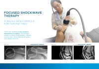 China 10bar Focused Extracorporeal Erectile Dysfunction Shock Wave Sale Shockwave Therapy Machine for sale