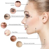 China Face Lifting Ems RF Wrinkle Removal And Skin Lifting Beauty Machine for sale