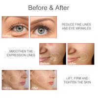 China RF Radio Frequency EMS  Facial Skin Beauty Device Vibration Skin Lifting Massager for sale