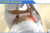 China Fat Burning Body Slimming Cellulite Remove Electric Face Ball Roller Therapy Machine for sale