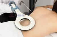 China Magnetolith Emtt Therapy Pulsed Electromagnetic Field Device Magnetotherapy for sale