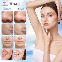 China 7 In1 Hydrafacial Machine Oxygen Facial Machine Nederland for sale