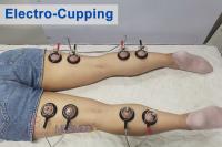 China Tens Electrotherapy Microcurrent Russian Waves Muscle Stimulation Cupping Therapy Massager for sale