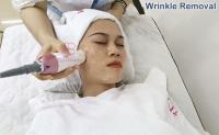 China 9D Hifu Focused Ultrasound Facial Smas Lifting Machine Anti-wrinkle Vmax Hifu 9d Facial And Body for sale
