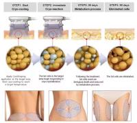 China Cryolipolysis Vertical 4 Handles Multifunctional Body Shape 360 Cool Cryolipolysis Slimming Machine Skin Tightening for sale
