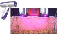 China Rf Fractional Microneedle Rf Face Lifting Anti Wrinkle Machine for sale