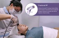 China Rf Fractional Microneedle Rf Face Lifting Anti Wrinkle Machine for sale