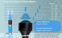 China Focal Focus Shockwave Device Erectile Dysfunction Treatment ESWT Focused Shock Wave Therapy Machine for sale