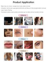 China Picosecond 532nm 755nm 1064nm Pigment Tattoo Laser Removal Machine for Pico Sale for sale