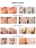 China NIR Milk Light Whitening Ice 808nm Diode Laser Device 4 Wavelength 755 808 940 1064 Diode Laser Hair Removal Machine for sale